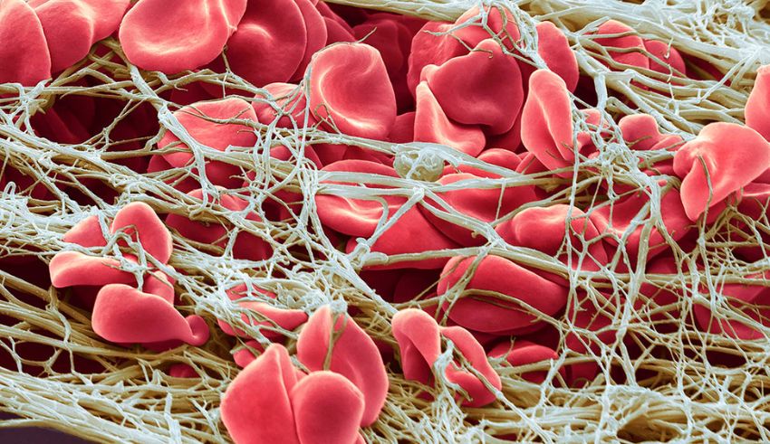 Long Covid: Brain Fog, Fatigue and Blood Clots – Study